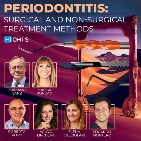 Periodontitis – Surgical and Non-Surgical Treatment Methods – Medhub ...